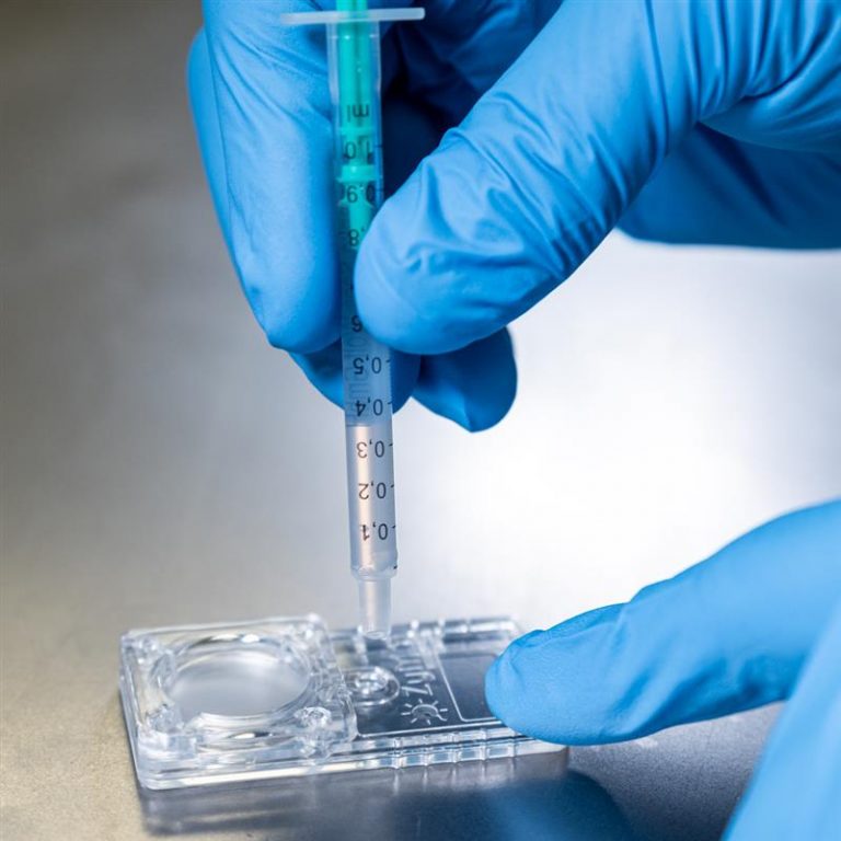 ZyMOT（ザイモート） | ART女性クリニック:熊本の不妊症専門クリニック